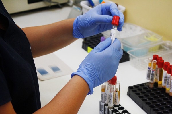 In House Blood Work | Rand Medical Center